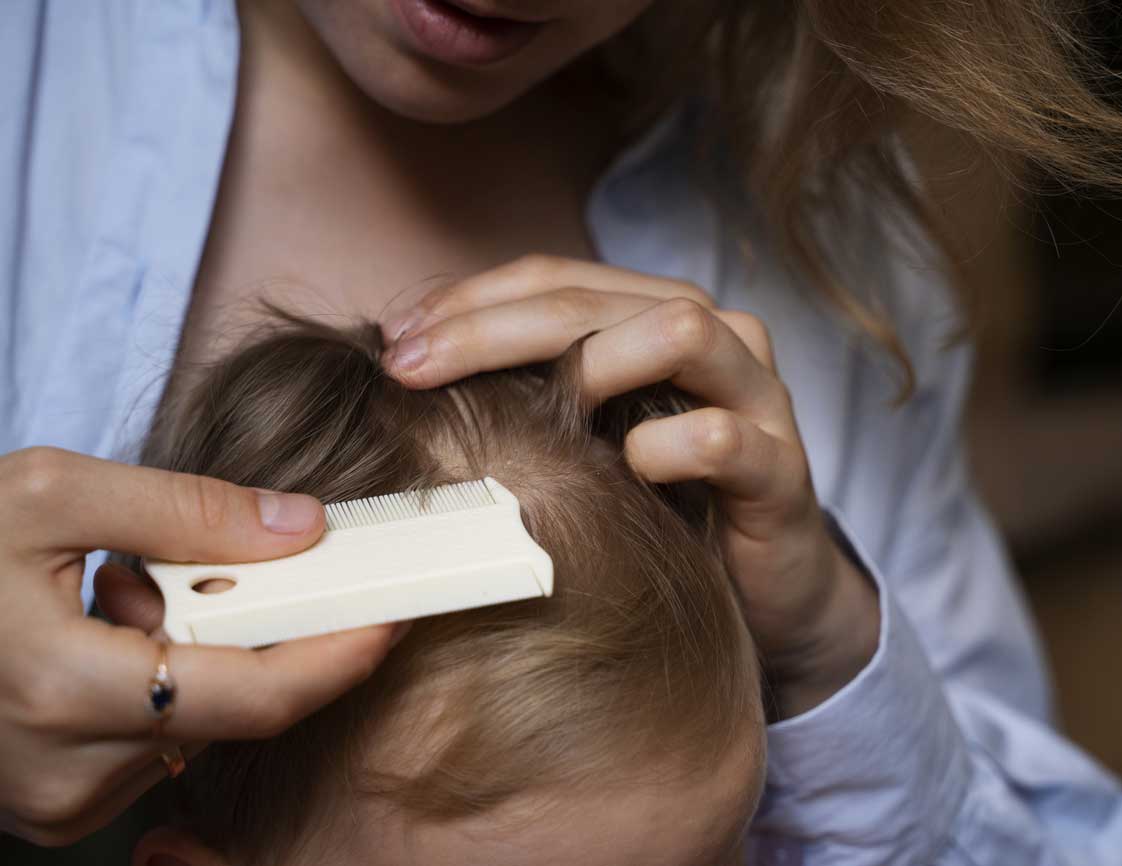 Rentrée scolaire : 5 actions pour protéger votre enfant des poux • Les ...